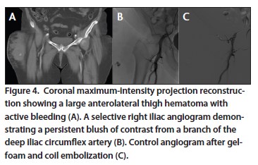 Endovascular Management of Upper and Lower Extremity Vascular Trauma ...