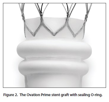 Preserving the Aortic Neck - Endovascular Today